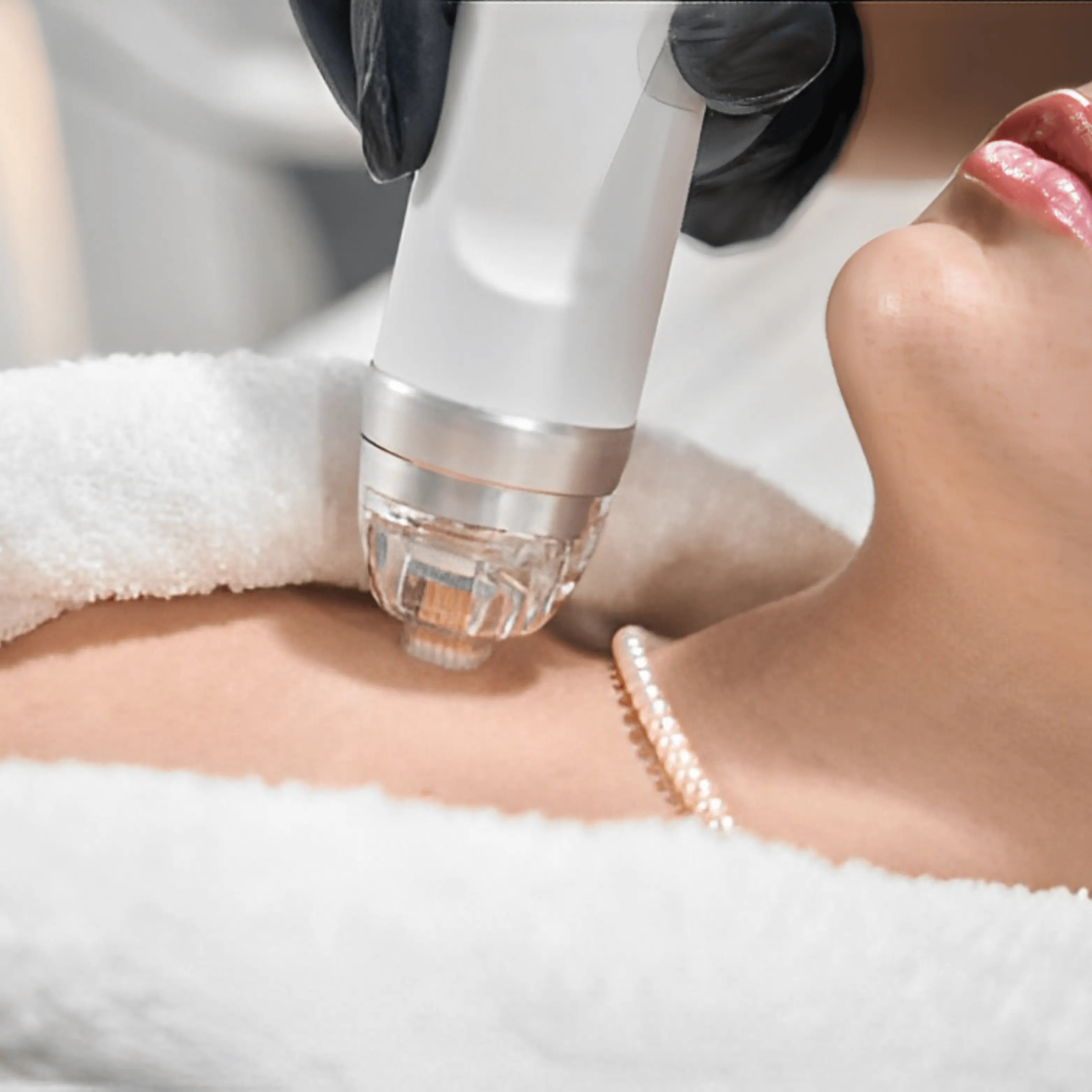 Everything You Want to Know About Microneedling Machines Is Here ...