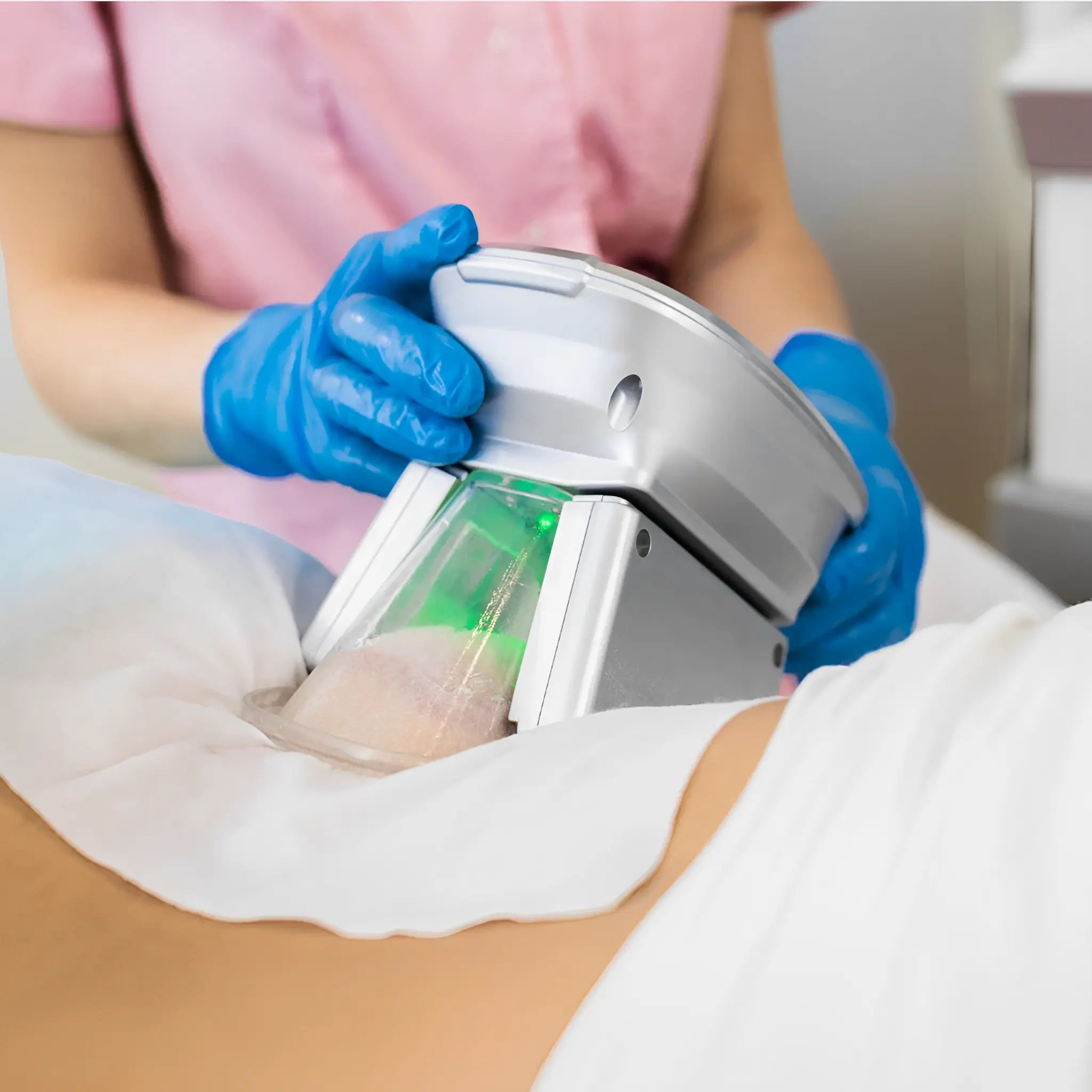 ¿Por qué esperar? CoolSculpting puede ser la respuesta a la grasa rebe ...